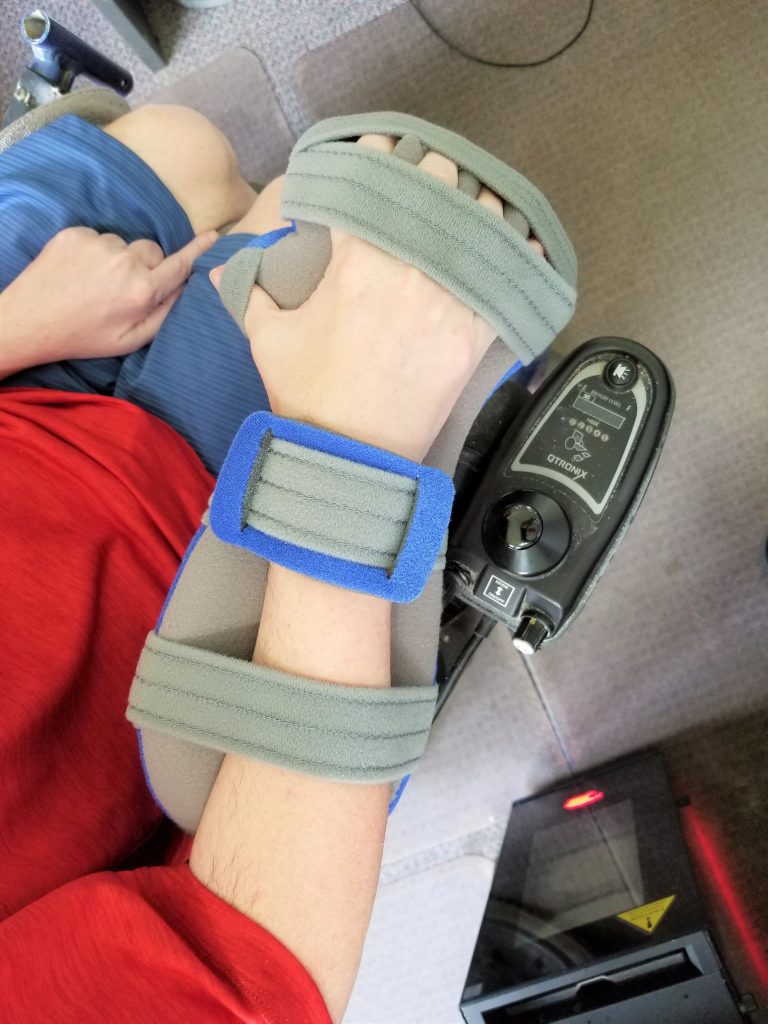 Importance of Maximizing Upper Extremity Functions With SMA Patients ...