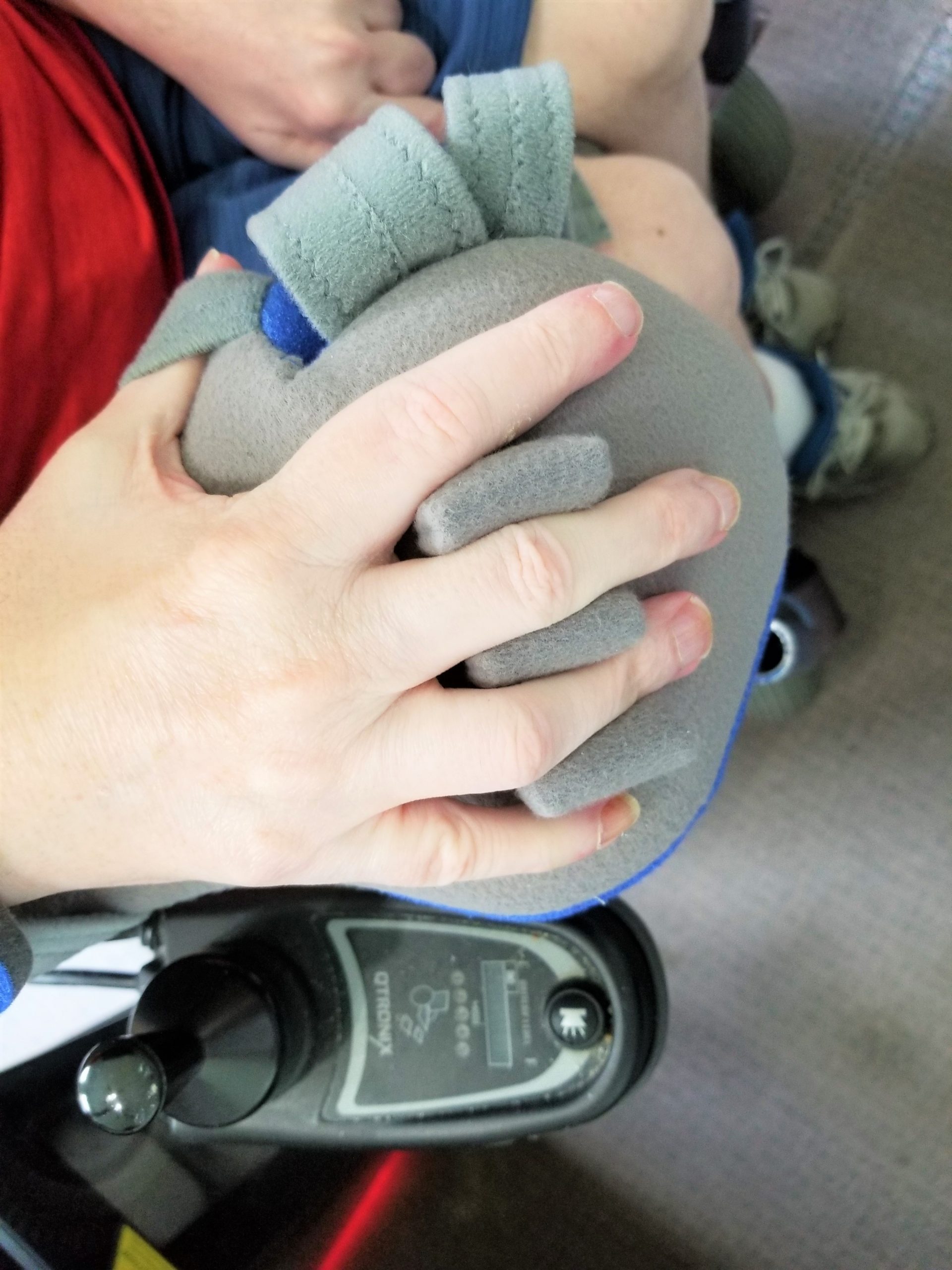 Importance of Maximizing Upper Extremity Functions With SMA Patients ...